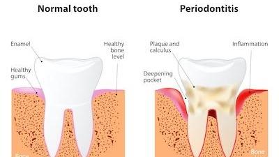 Pledge to Keep You Smile Healthy in 2021 | Pikesville Dental